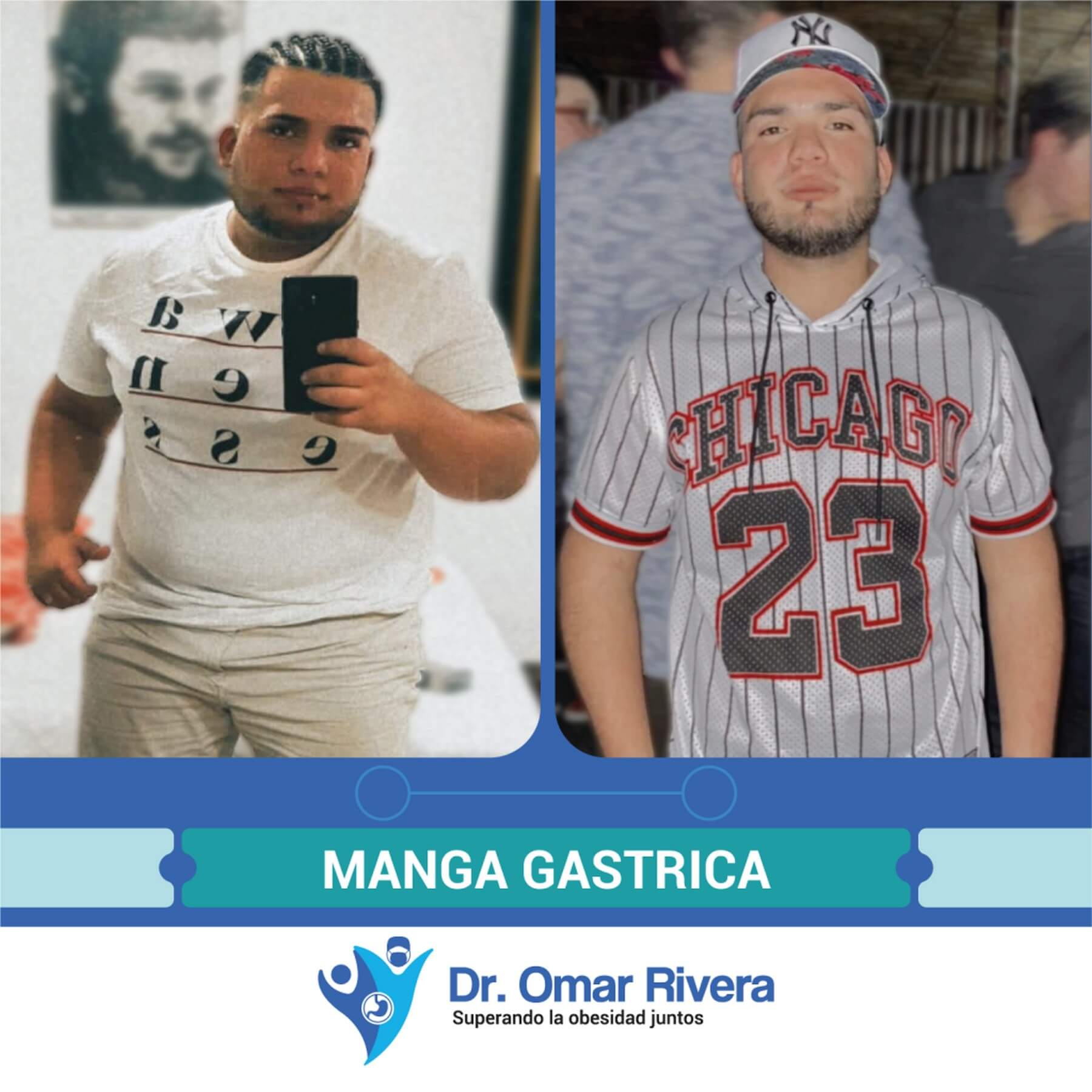 Antes y Después - Dr Omar Rivera